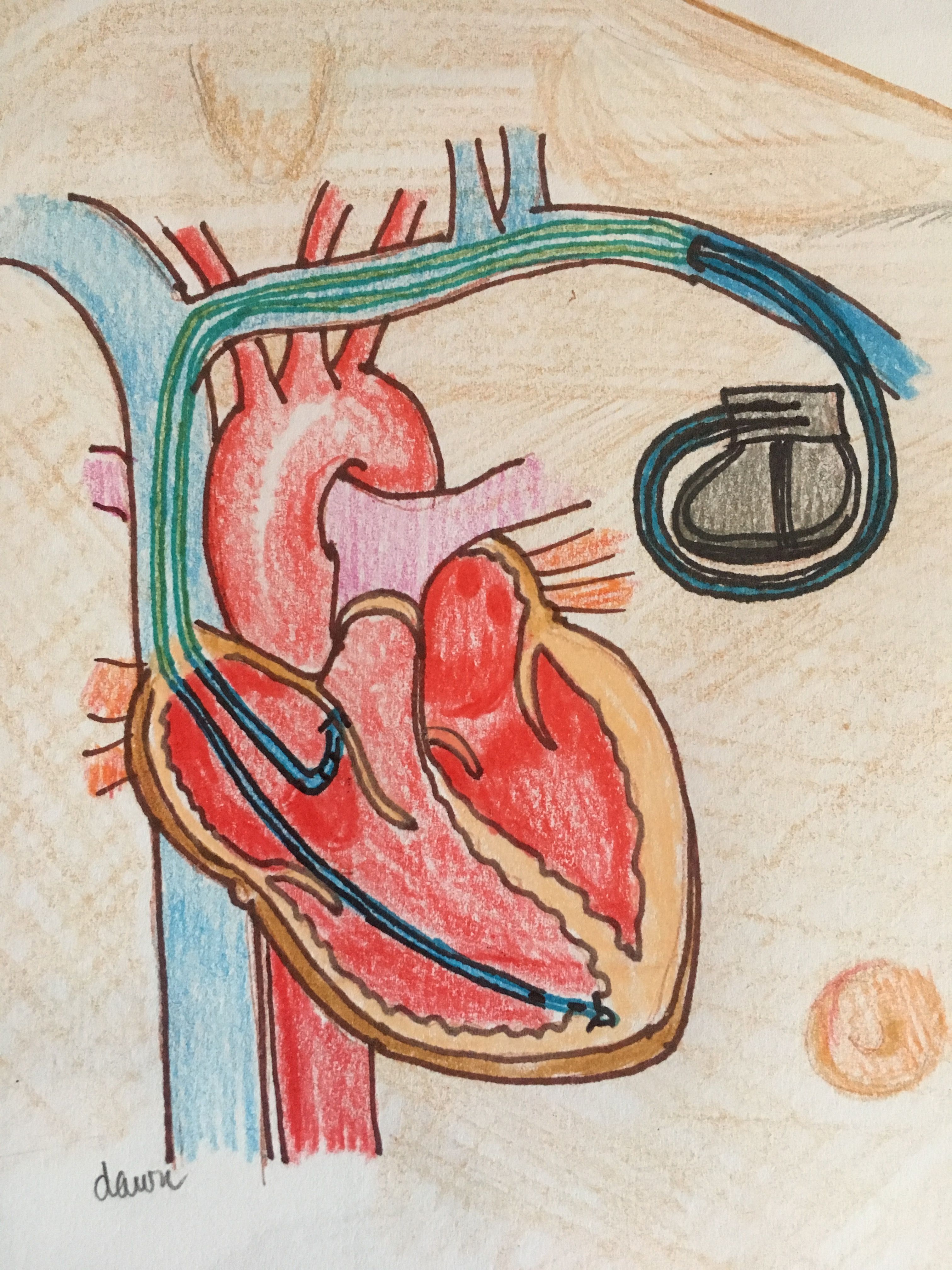 Heart Art Page 2 ECG Guru Instructor Resources Heart Art Page 2 ECG Guru Instructor Resources
